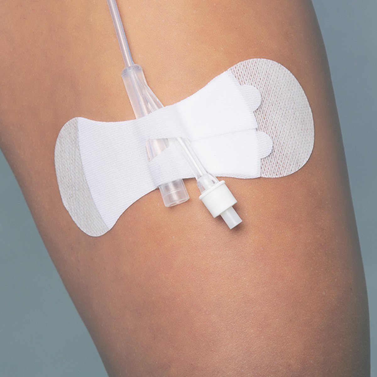 Grip-Lok Securement Devices: Optimized for Patient Comfort and Safety