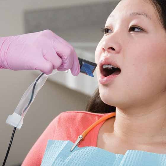 Dental X-Ray Sensor Sheath Covers - TIDI Products 20979